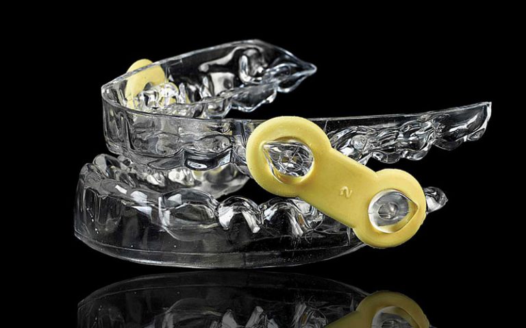 Sleep Apnea and Anti-Snore Devices - Seattle Smiles Dental