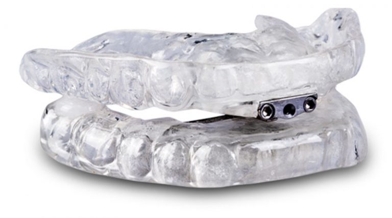 Sleep Apnea and Anti-Snore Devices - Seattle Smiles Dental